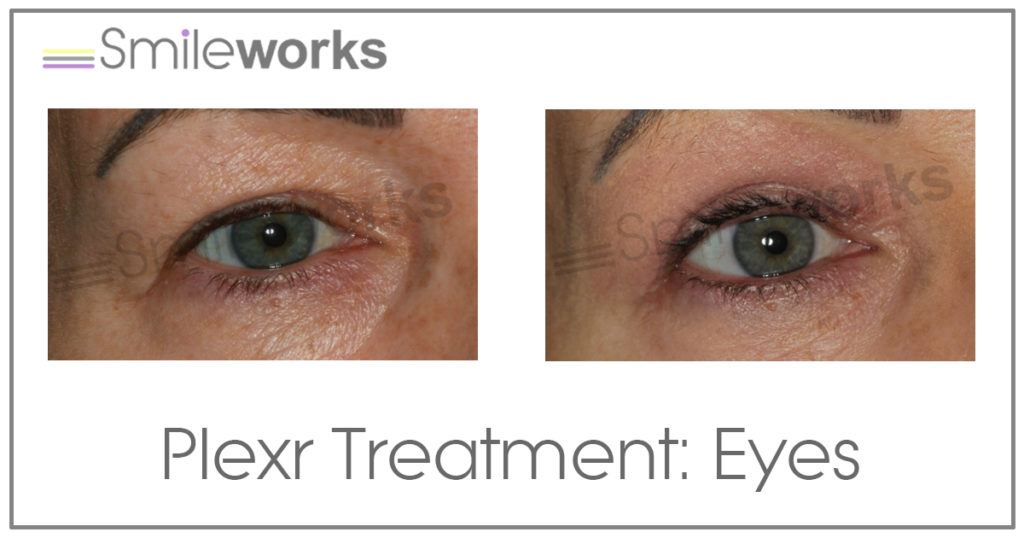 Plexr Review | Unbiased reviews from patients, practitioners and experts