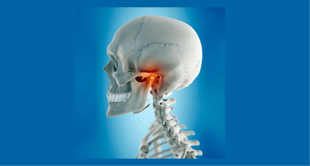 Advanced Orthodontics at Smileworks | TMJ Pain & Dysfunction